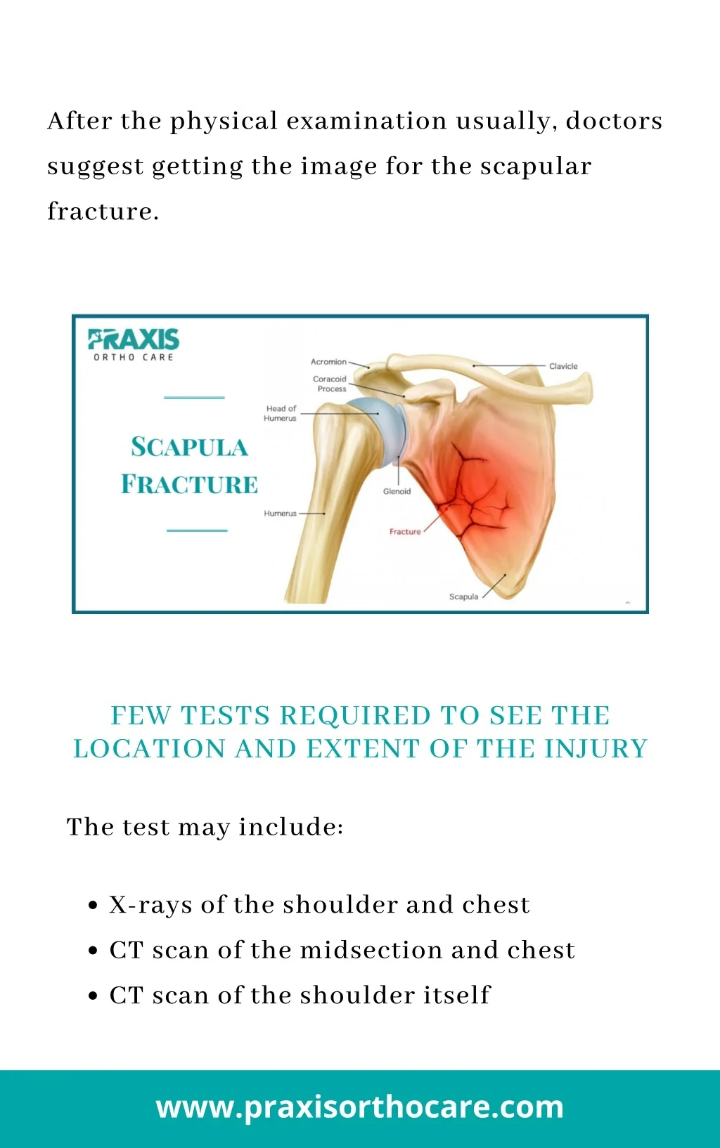 PPT - Diagnosis of Scapula Fracture | Best Shoulder Pain Treatment in ...