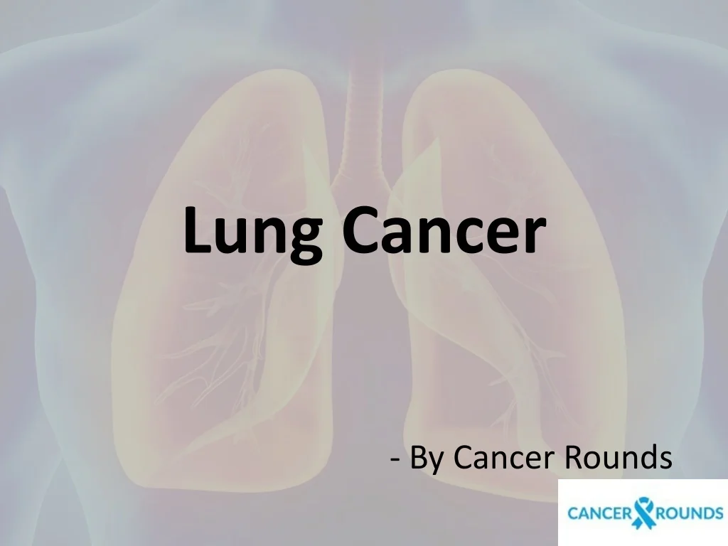 PPT - Lung Cancer PowerPoint Presentation, free download - ID:10191957