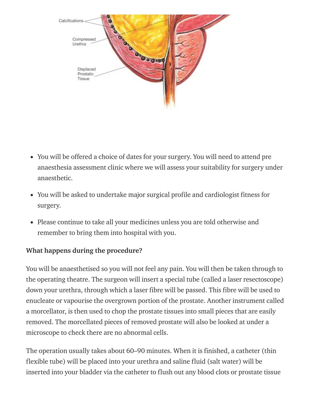 PPT - Holep Laser Prostectomy | Dr. Shyam Varma PowerPoint Presentation ...