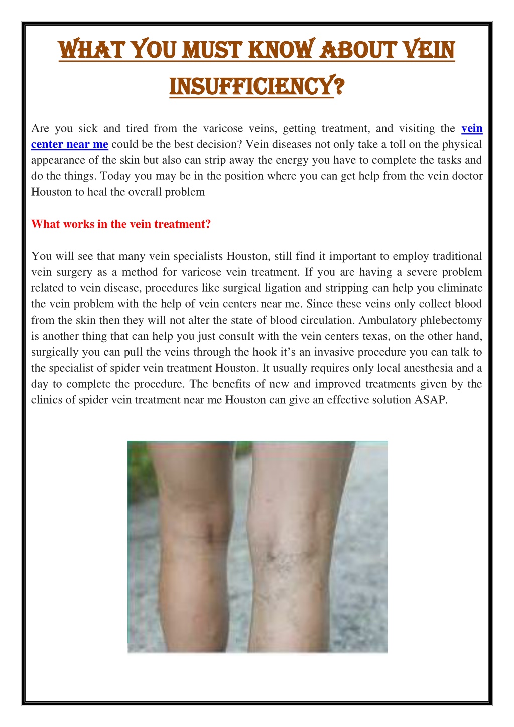 Ppt What You Must Know About Vein Insufficiency Powerpoint
