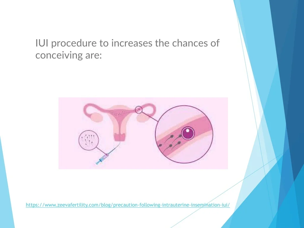 PPT - IUI treatment in noida PowerPoint Presentation, free download ...