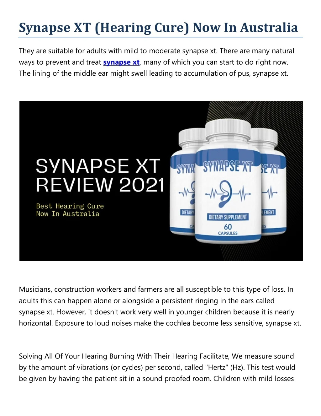 PPT - Synapse XT Review - WARNING! Read Before Buy PowerPoint ...