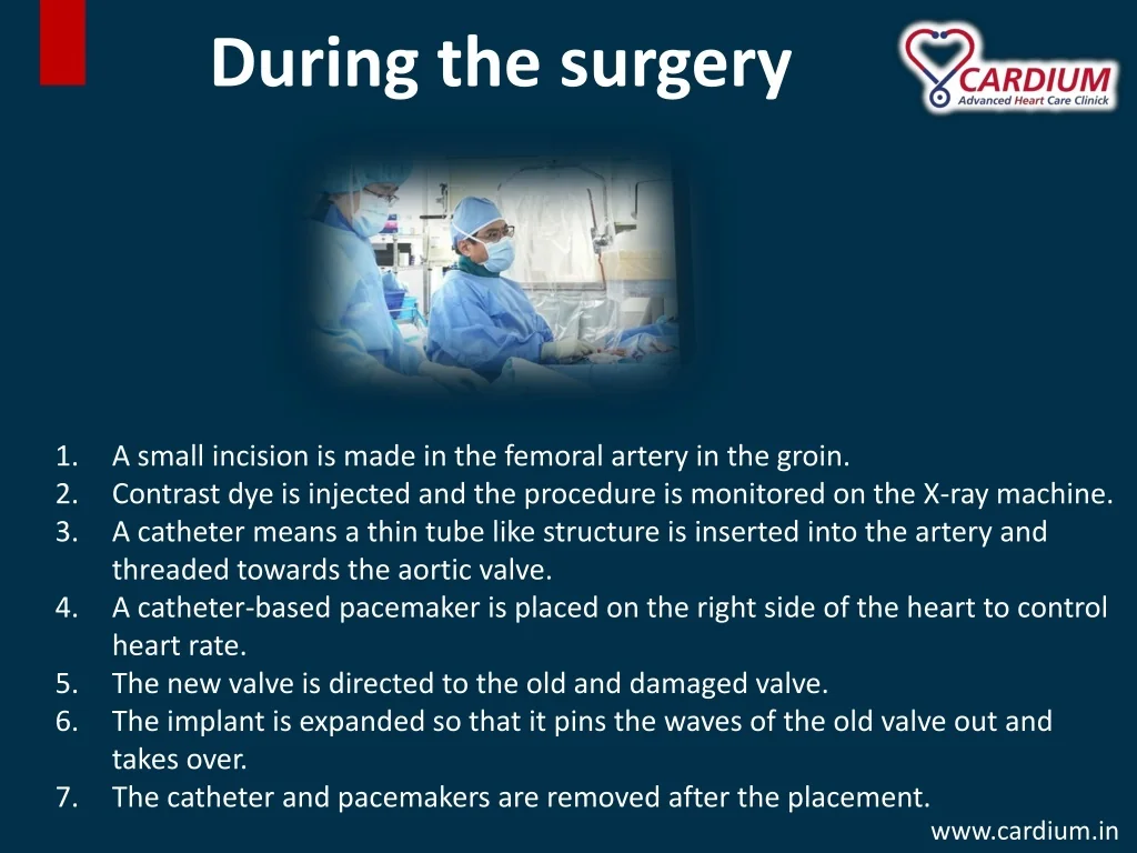PPT - Transcatheter Aortic Valve Implantation (TAVI) | Surgical ...