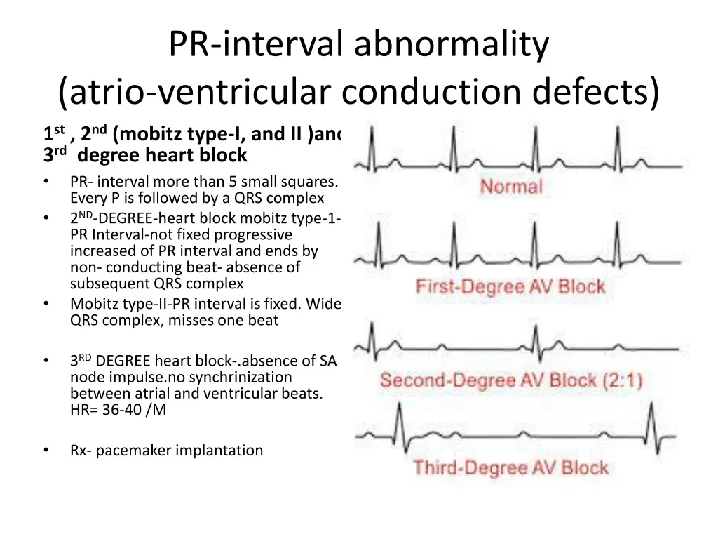 PPT - Investigations in cardiovascular diseases by dr. rkdhaugoda ...