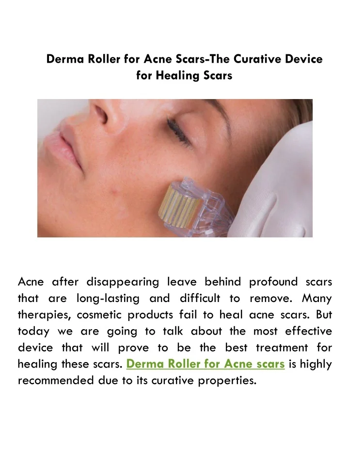 PPT - Derma Roller for Acne Scars-The Curative Device for Healing Scars ...