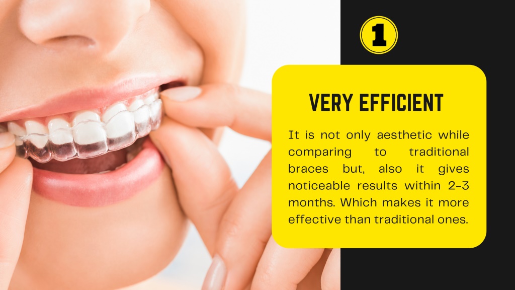 Ppt 5 Things To Know Before Getting Invisalign Powerpoint