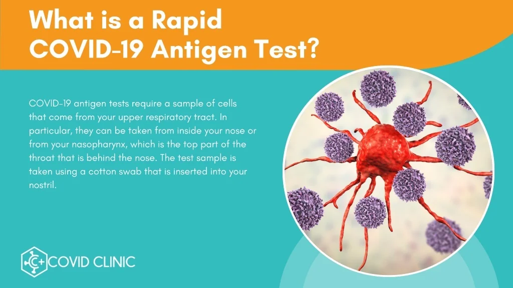 PPT - How Do COVID-19 Antigen Tests Work? - Covid Clinic PowerPoint ...