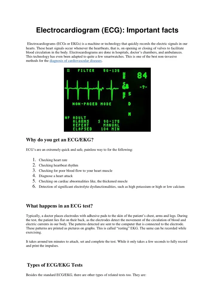 PPT - Electrocardiogram (ECG)_ Important facts PowerPoint Presentation ...