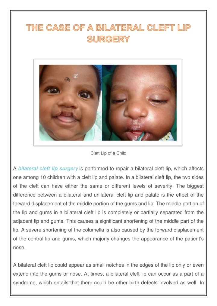 PPT - The Case of a Bilateral Cleft Lip Surgery | Richardson Hospital ...