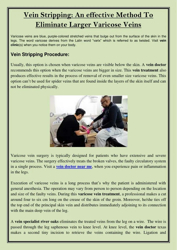 PPT - Vein Stripping An effective Method To Eliminate Larger Varicose ...