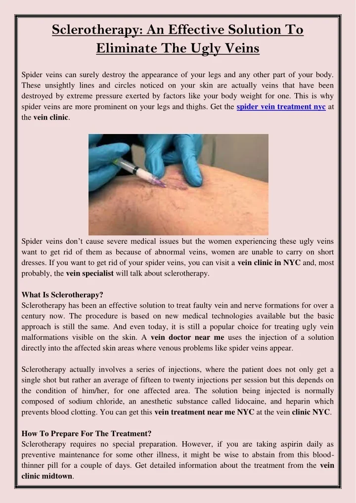 PPT - Sclerotherapy An Effective Solution To Eliminate The Ugly Veins ...