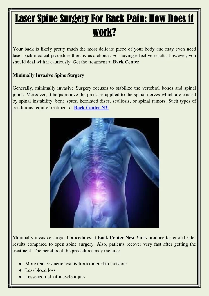 PPT - Laser Spine Surgery For Back Pain How Does it work PowerPoint ...