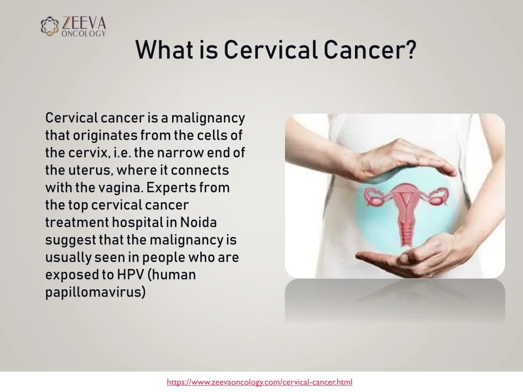 PPT - Cervical Cancer Treatment Hospital in Noida| Doctor & Specialist ...