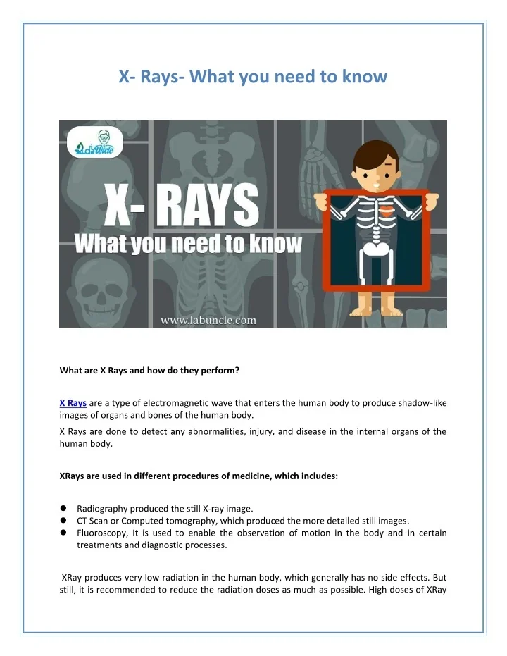 PPT - X- Rays- What you need to know PowerPoint Presentation, free ...