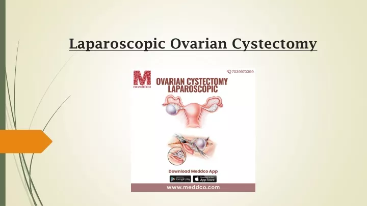Ppt Laparoscopic Ovarian Cystectomy Meddco Powerpoint Presentation