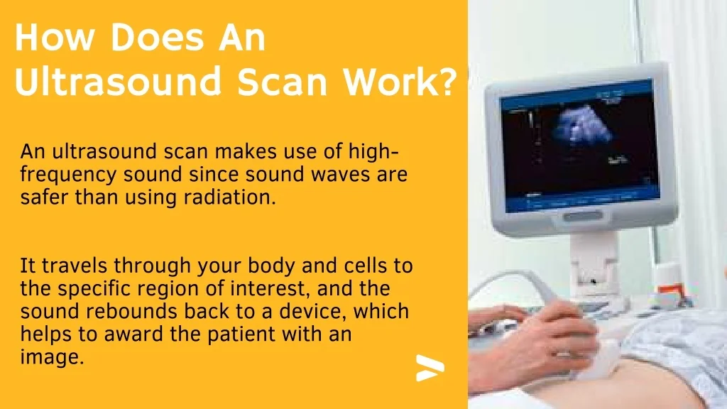 PPT - Key Things to Know Before Your Pelvic Ultrasound Scan PowerPoint ...