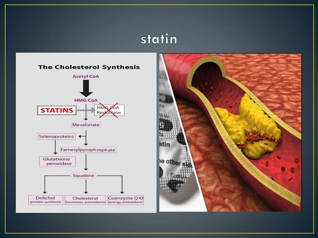PPT - Statin drugs-are they worth the risks PowerPoint Presentation ...