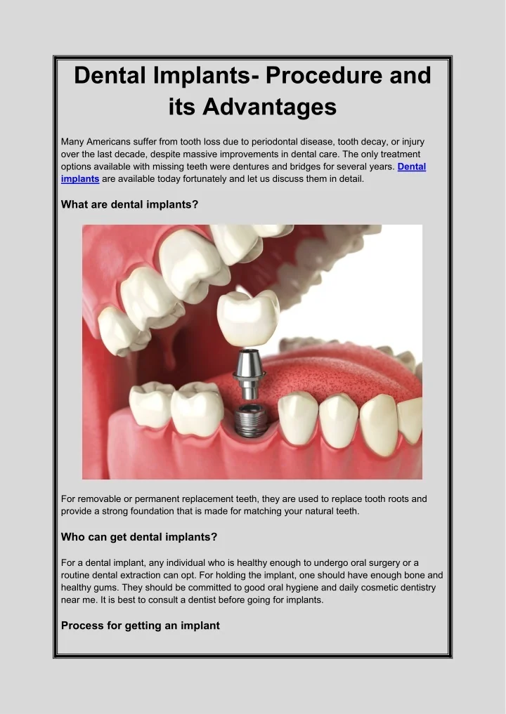 PPT - Dental Implants- Procedure and its Advantages PowerPoint ...