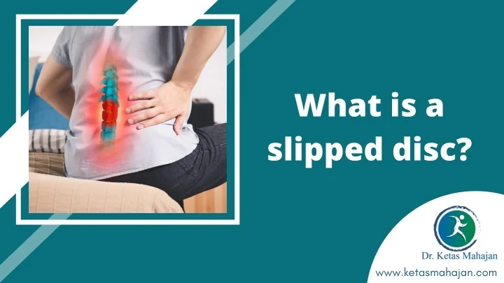 PPT - What is a slipped disc? What are the symptoms of a slipped disc ...