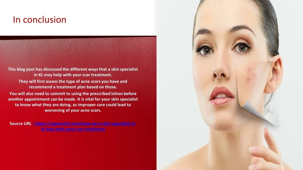 PPT - How Can A Skin Specialist in KL Help With Acne Scar Treatment ...