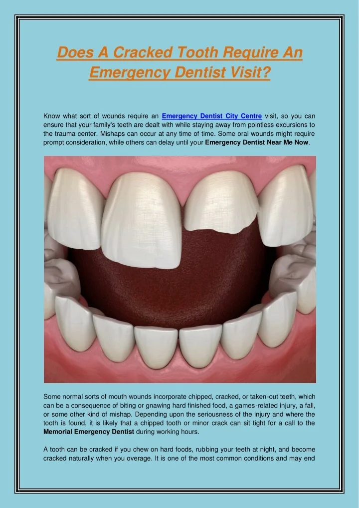 PPT - Does A Cracked Tooth Require An Emergency Dentist Visit ...