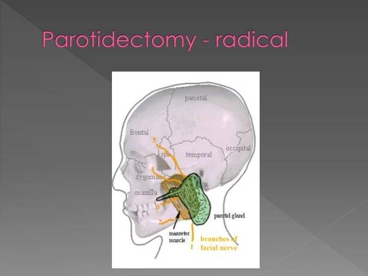 PPT - Parotidectomy radical - Meddco PowerPoint Presentation, free ...