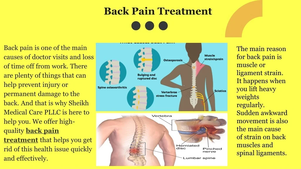 PPT - Best Back Pain Treatment In New York | Sheikh Medical Care ...