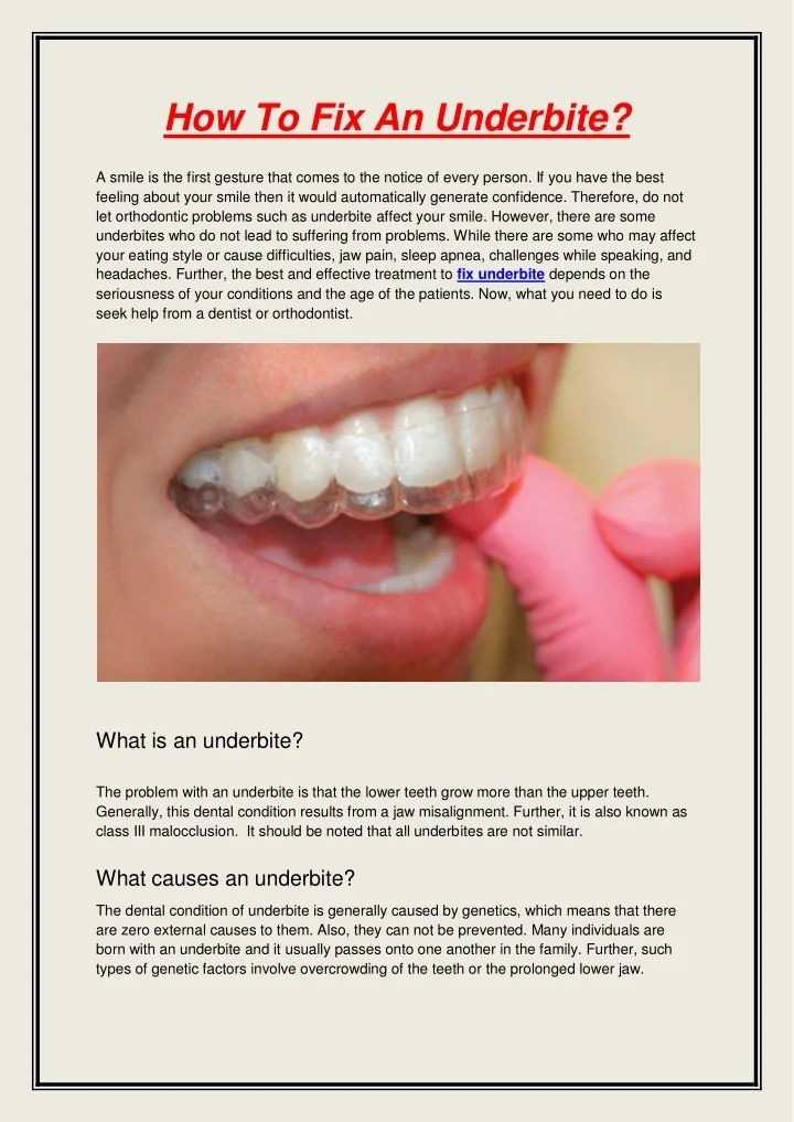 PPT - How To Fix An Underbite PowerPoint Presentation, free download ...