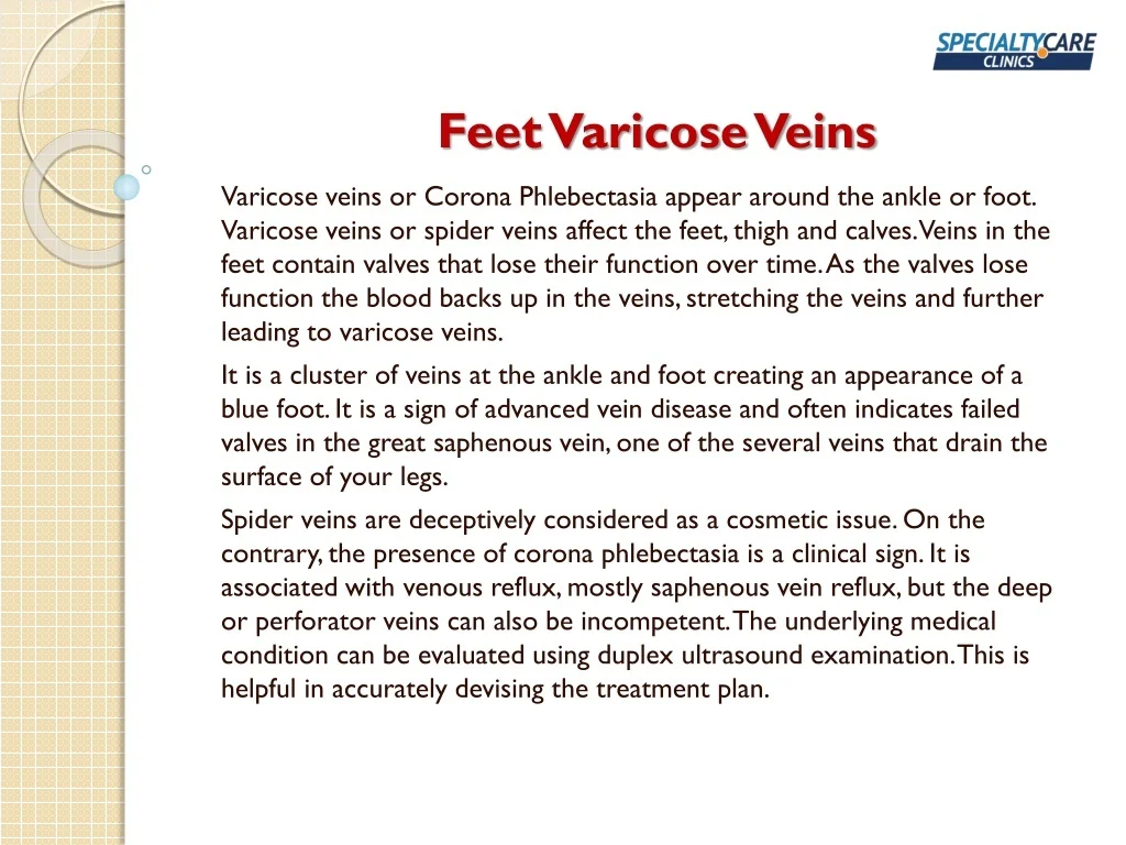PPT - Varicose Veins - Causes, Symptoms and Treatment PowerPoint ...