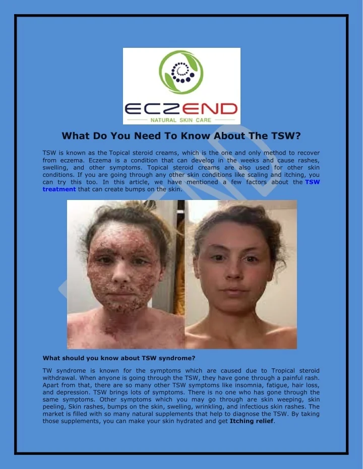 PPT - What Do You Need To Know About The TSW? PowerPoint Presentation ...