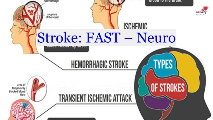 PPT - Stroke_ FAST – Neuro PowerPoint Presentation, free download - ID ...