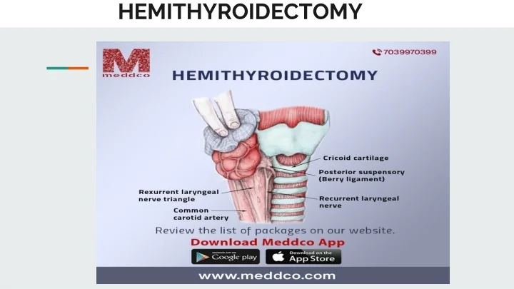 PPT - Hemithyroidectomy PowerPoint Presentation, free download - ID ...