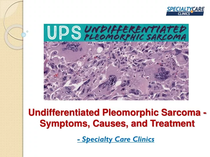 Ppt Undifferentiated Pleomorphic Sarcoma Symptoms Causes And