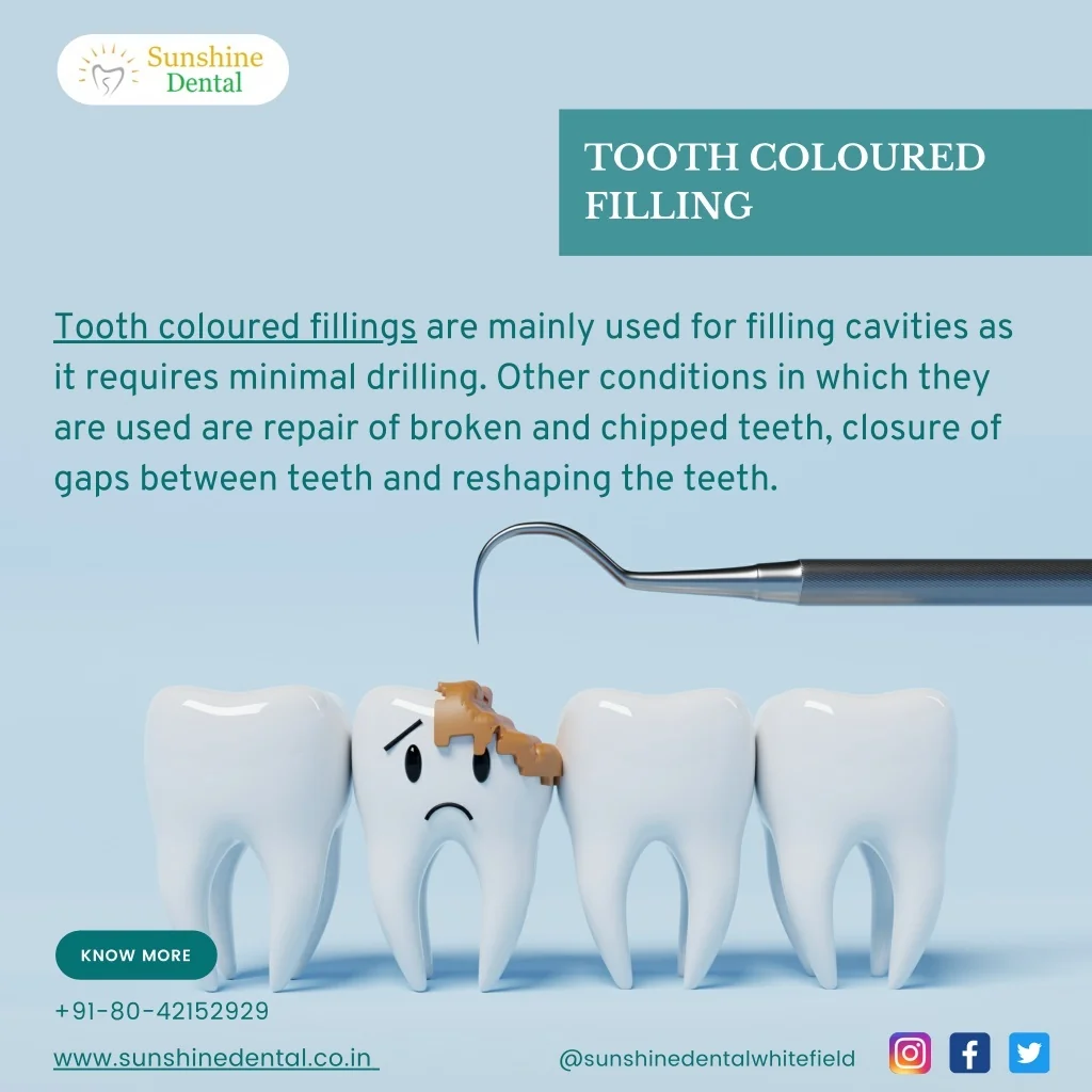 PPT - Tooth Coloured Filling | Best Dental Treatment in Whitefield ...