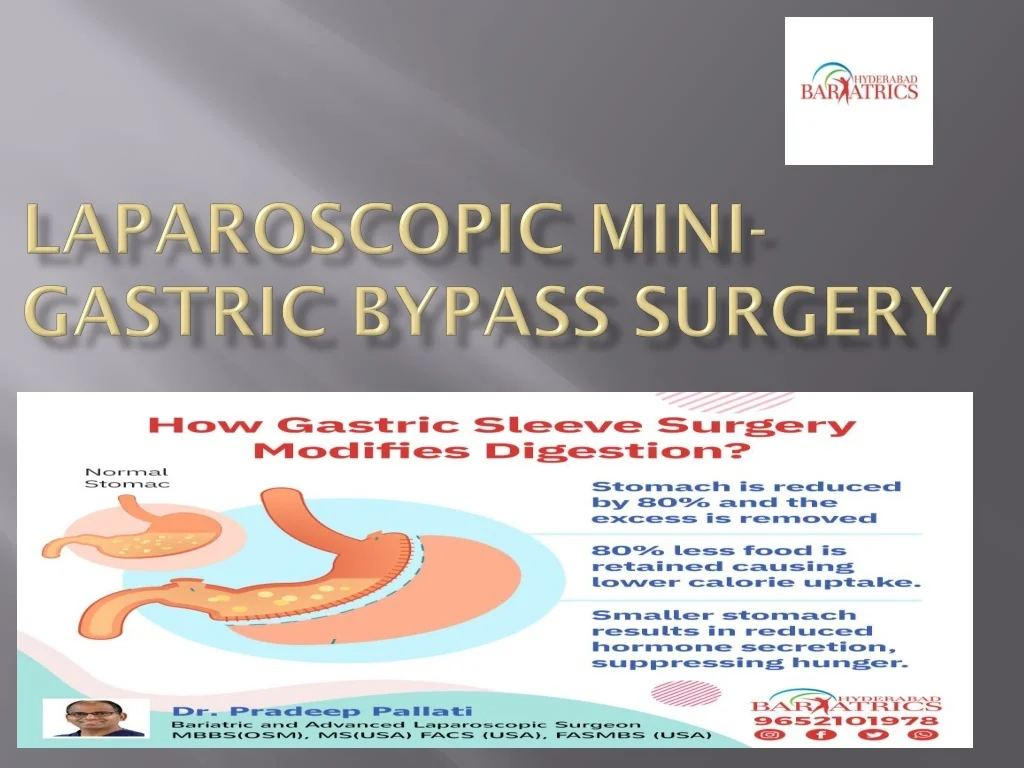 PPT - Best Laparoscopic Mini-Gastric Bypass Surgery in Hyderabad ...