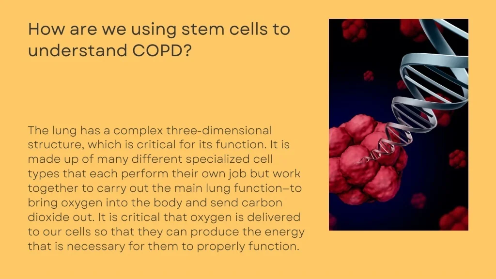 PPT - STEM CELL THERAPY FOR COPD | DR. DAVID GREENE ARIZONA PowerPoint Presentation - ID:11179091