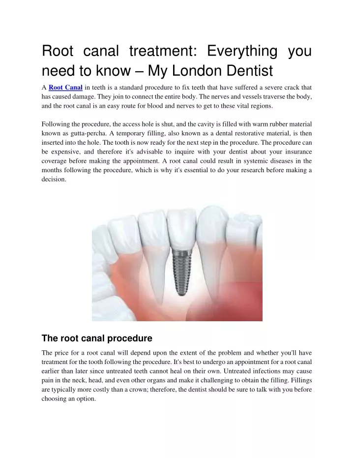 PPT - Root canal treatment_ Everything you need to know – My London ... PPT - Root canal treatment_ Everything you need to know – My London ...