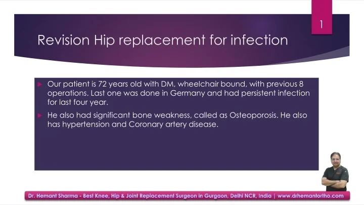 PPT - Revision Hip replacement for infection PowerPoint Presentation ...