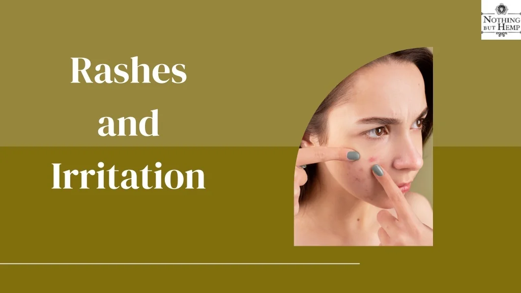 PPT - Few Tips How Delta 8 THC May Be Effective For Skincare PowerPoint ...