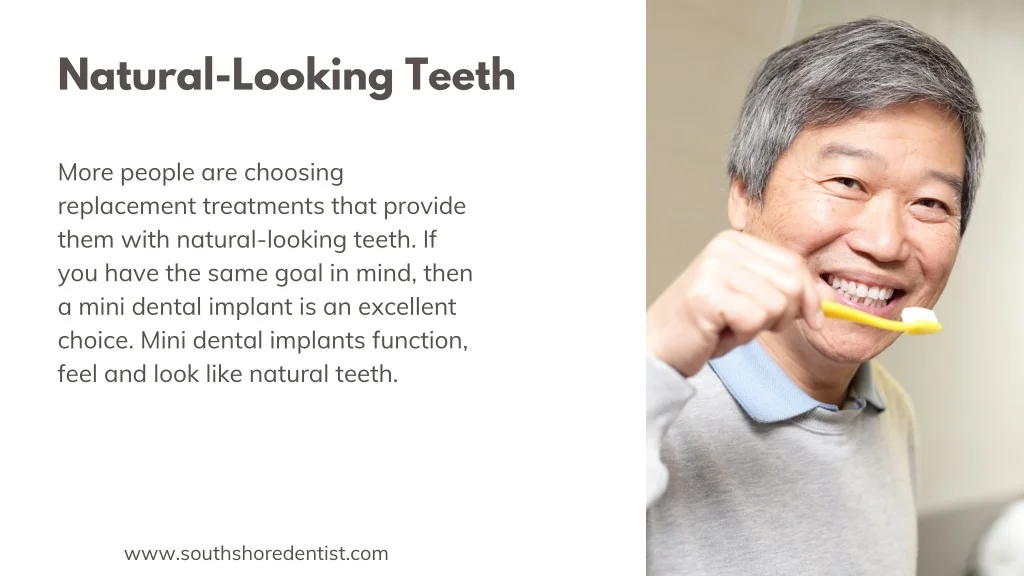 PPT - Health Benefits Of Mini Dental Implants PowerPoint Presentation ...