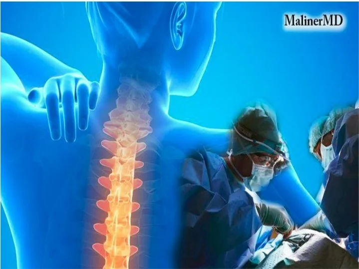 PPT - Brain Surgery Doctor in Florida PowerPoint Presentation, free ...