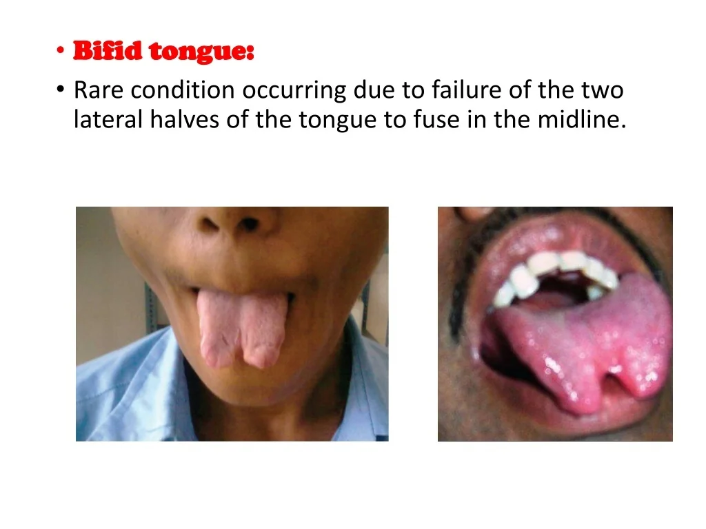 PPT - GI 01. Diseases Of The Oral Cavity PowerPoint Presentation, free ...