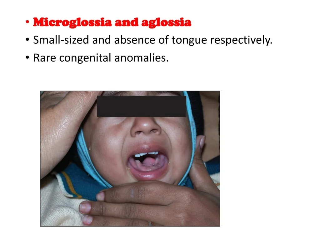 PPT - GI 01. Diseases Of The Oral Cavity PowerPoint Presentation, free ...