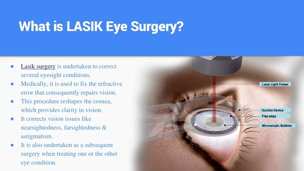 PPT - Lasik Eye Surgery Treatment | ASG Eye Hospitals PowerPoint ...
