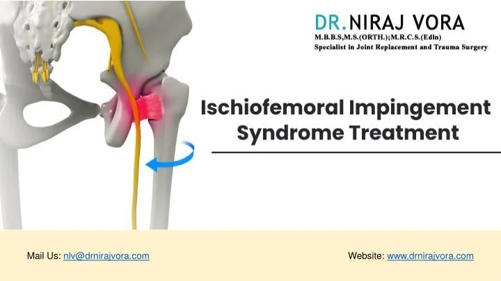 PPT - Ischiofemoral Impingement Syndrome Treatment | Dr Niraj Vora ...