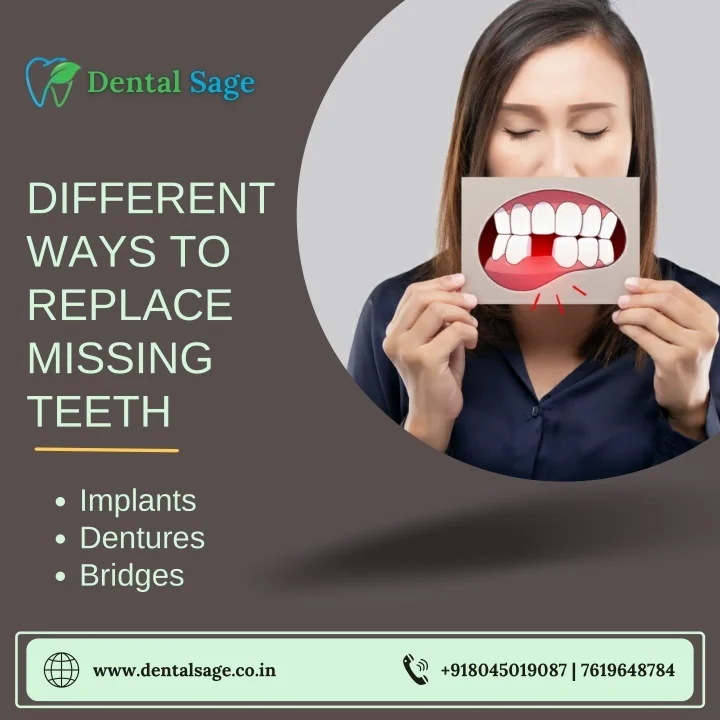 PPT - Ways to replace your missing teeth | Dental Clinic in Yelahanka ...