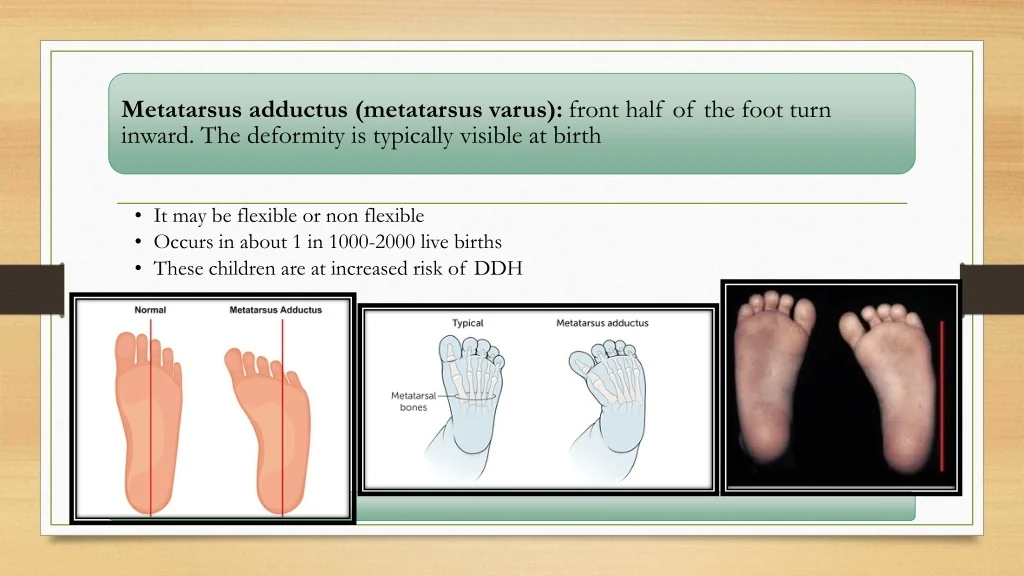 PPT - Abnormal Gait By Dr Chaman Lal PT PowerPoint Presentation, free ...