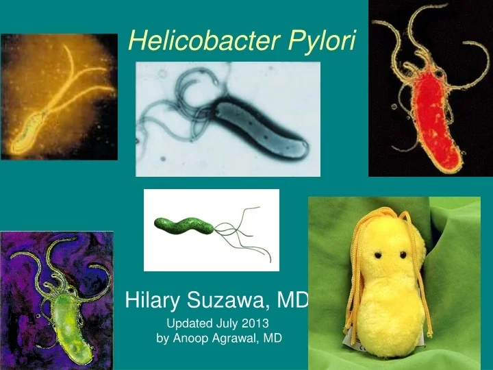 PPT - Helicobacter Pylori PowerPoint Presentation, free download - ID ...