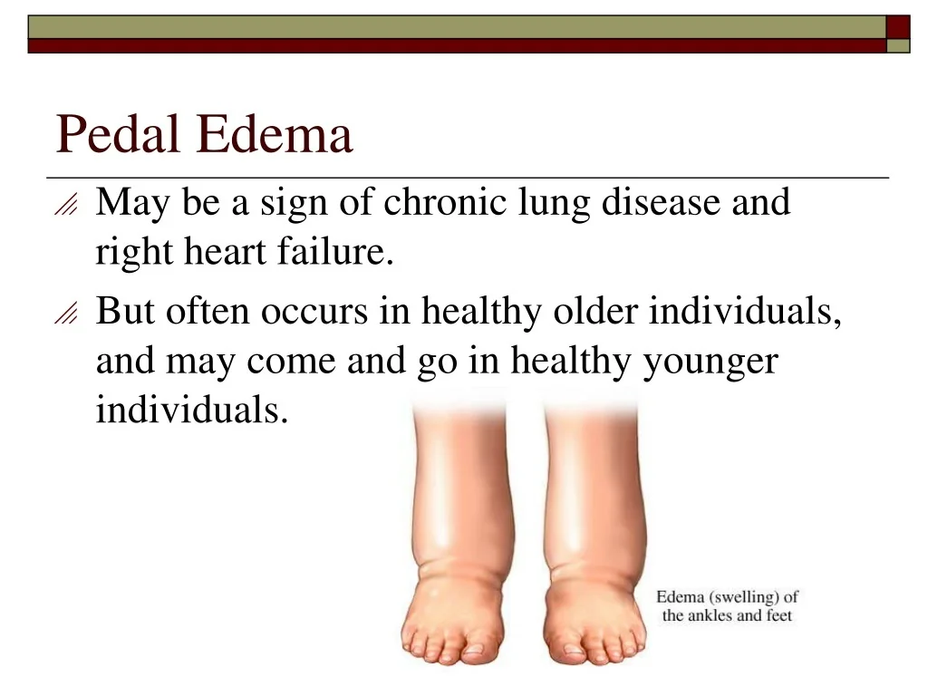 PPT Physical Examination continued PowerPoint Presentation Free
