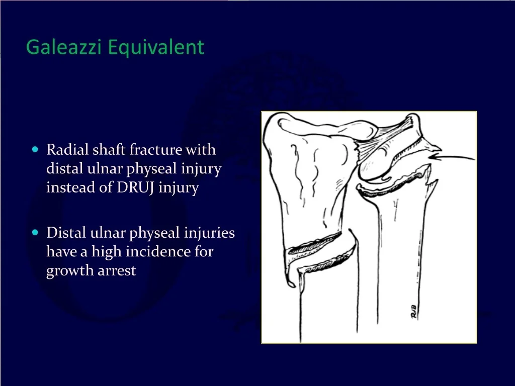 PPT Pediatric Forearm Fractures Diagnosis And Treatment Guide PPT Pediatric Forearm Fractures Diagnosis And Treatment Guide